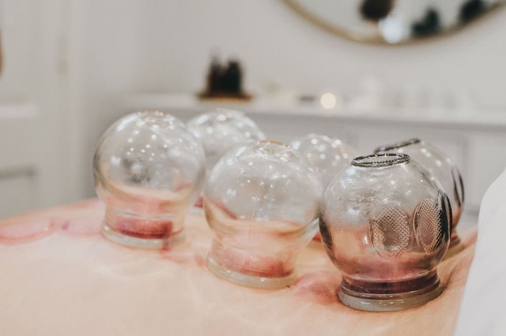 Exploring the Benefits of Fire Cupping in Pain Management and ...