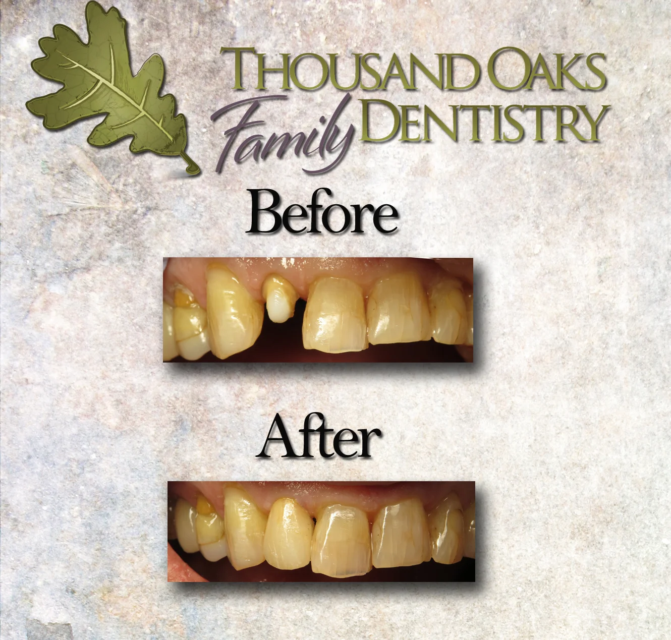 Case Presentation: Crown Delivery