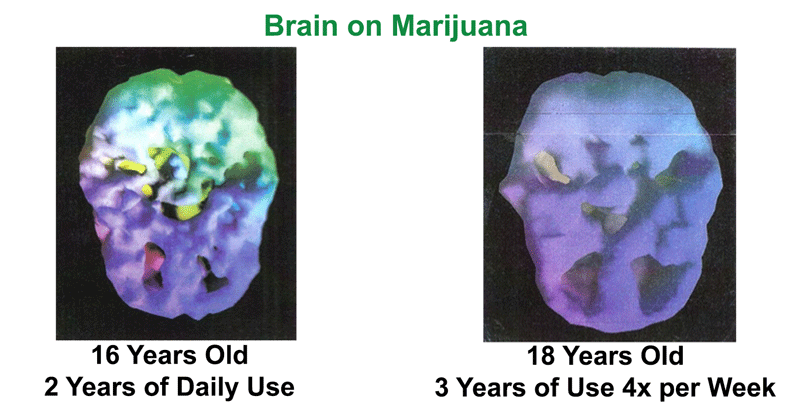 Before And After Weed Users