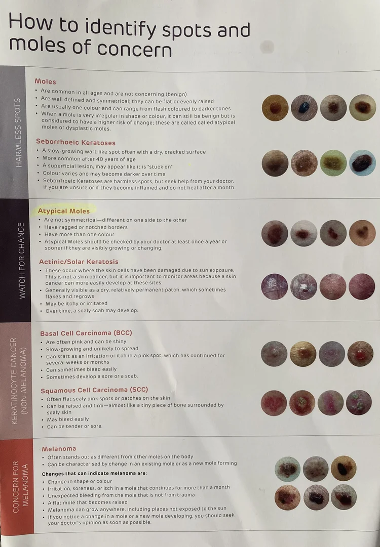 Mole Check Technology for Skin Cancer Screening: An Interview with ...