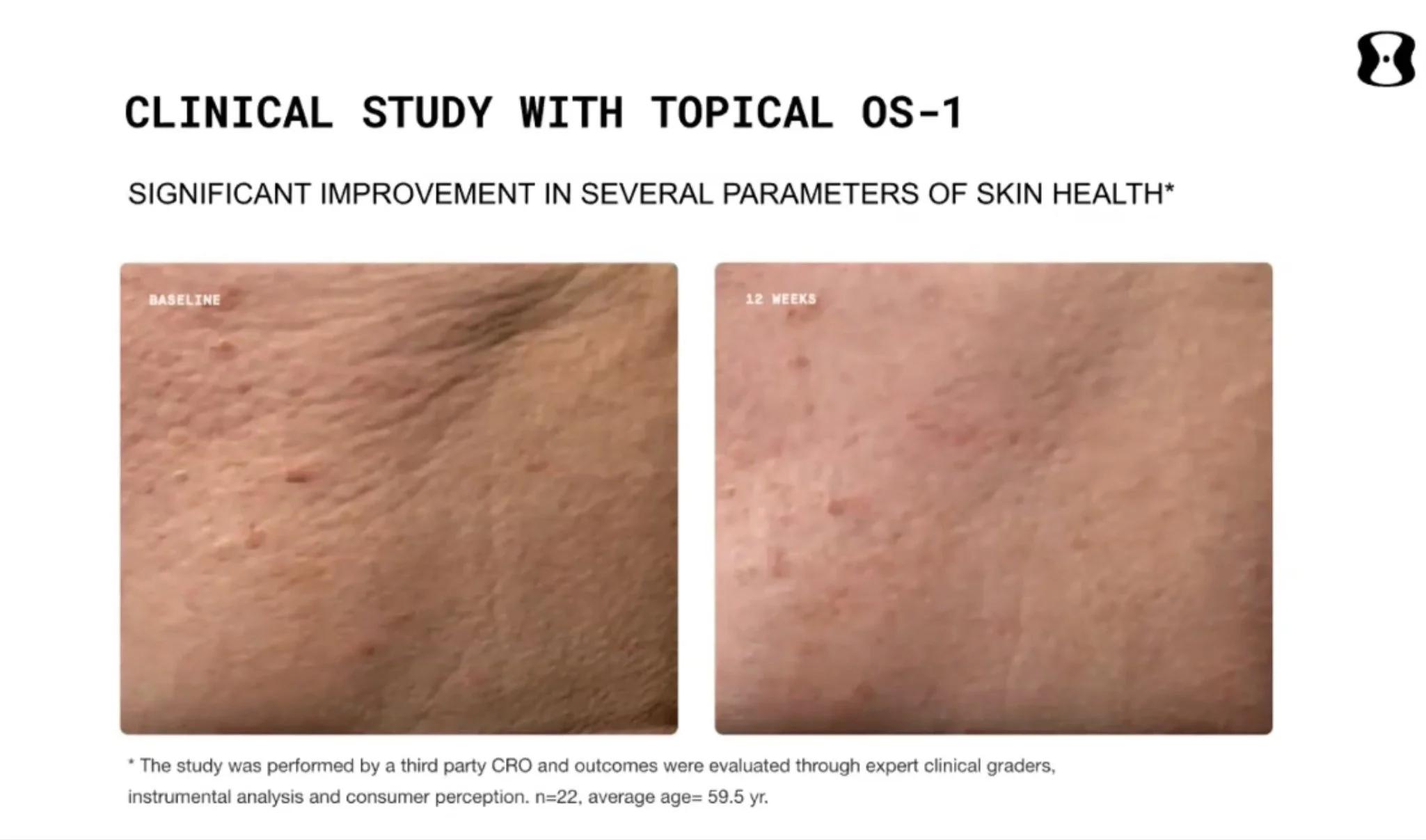 OneSkin Review - Before and After with Images — A Longer Life