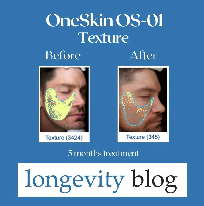 OneSkin Review - Before and After with Images — nickengerer.org