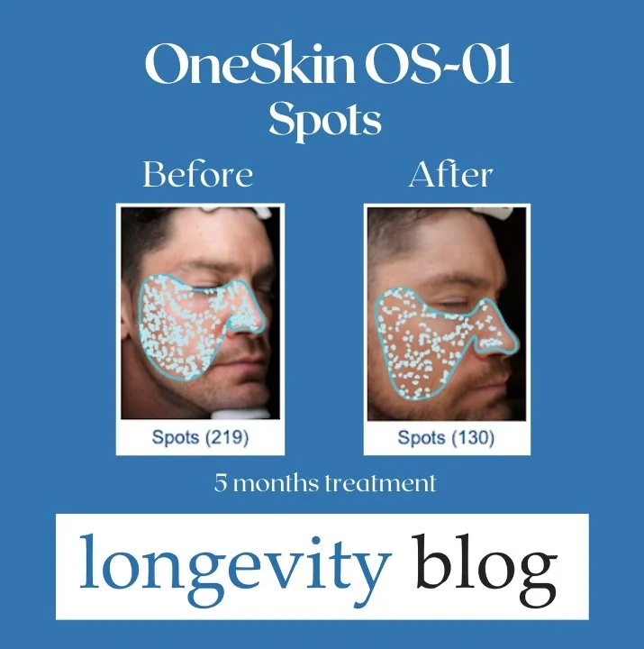 OneSkin Review - Before and After with Images — nickengerer.org