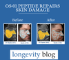 OneSkin Review - Before and After with Images — nickengerer.org