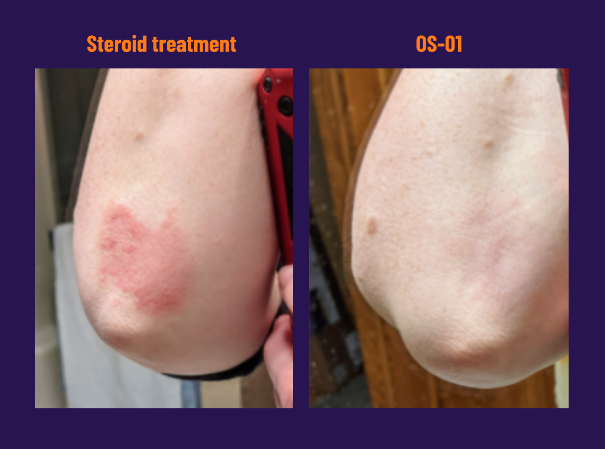 OneSkin OS-1 Does it Work? The Science Says Yes — A Longer Life