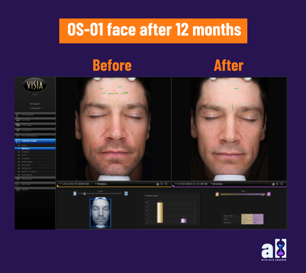 OneSkin Review - Before and After with Images — A Longer Life
