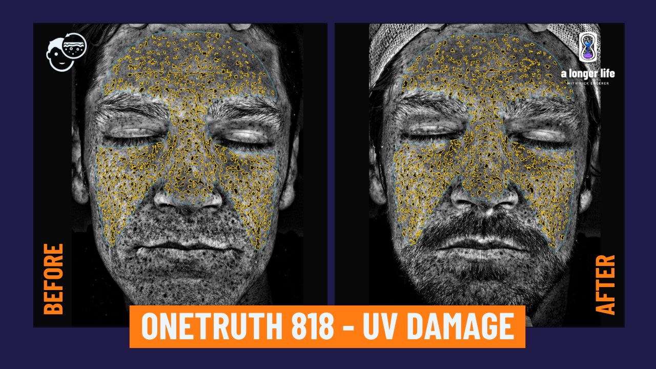 One Truth 818 Review with Before and After Images — nickengerer.org