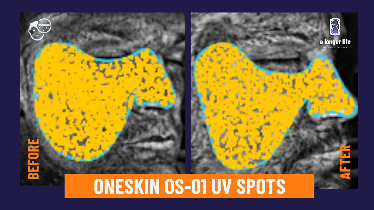OneSkin Review - Before and After with Images — A Longer Life