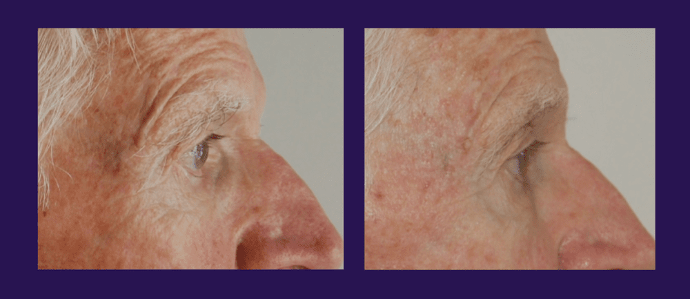 OneSkin OS-1 Does it Work? The Science Says Yes — A Longer Life