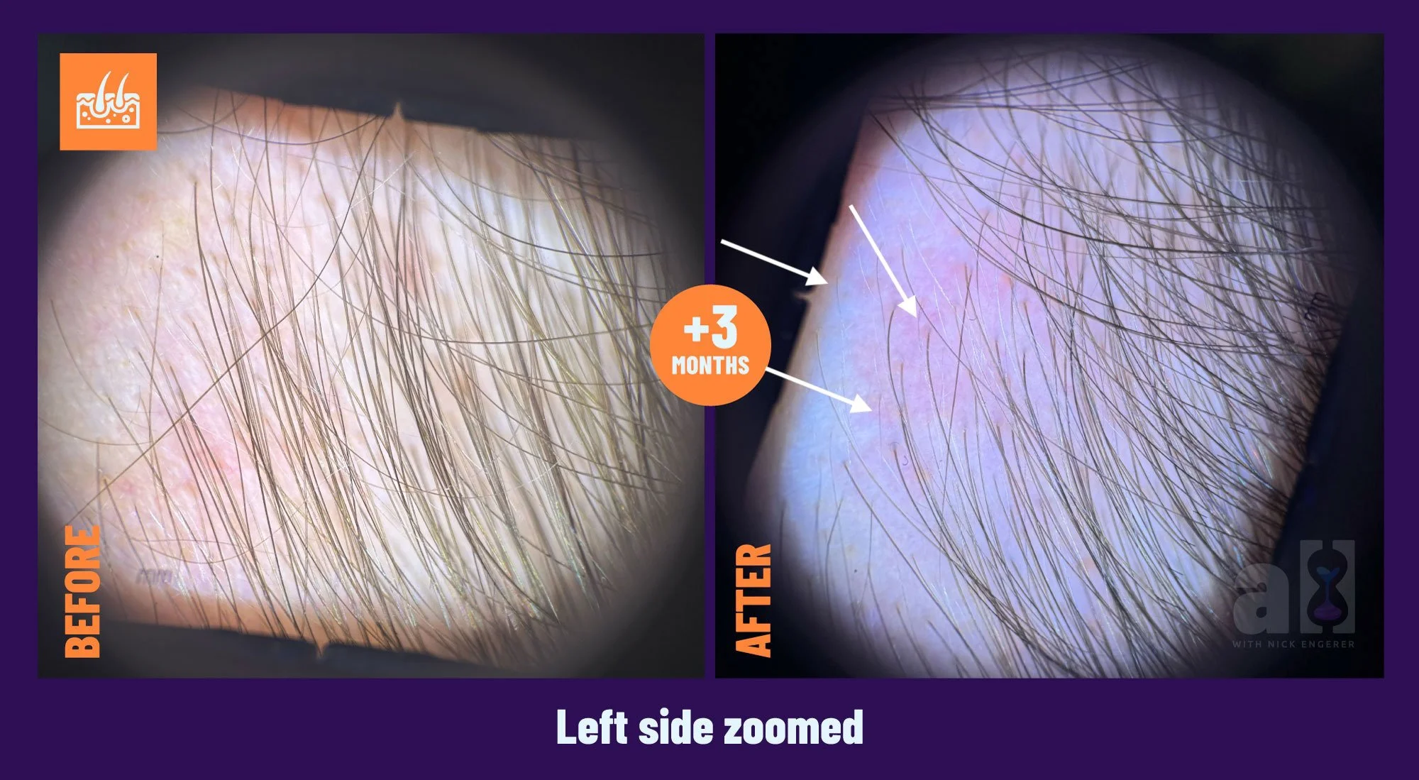 OneSkin Hair Serum Review: My 6-Month OS-01 Before/After Results — A ...