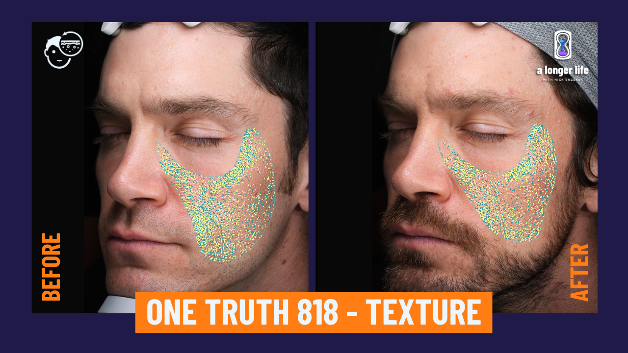 One Truth 818 Review with Before and After Images — A Longer Life