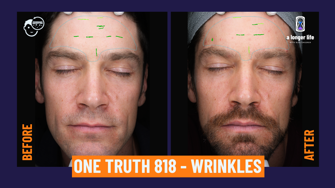 One Truth 818 Review with Before and After Images — A Longer Life