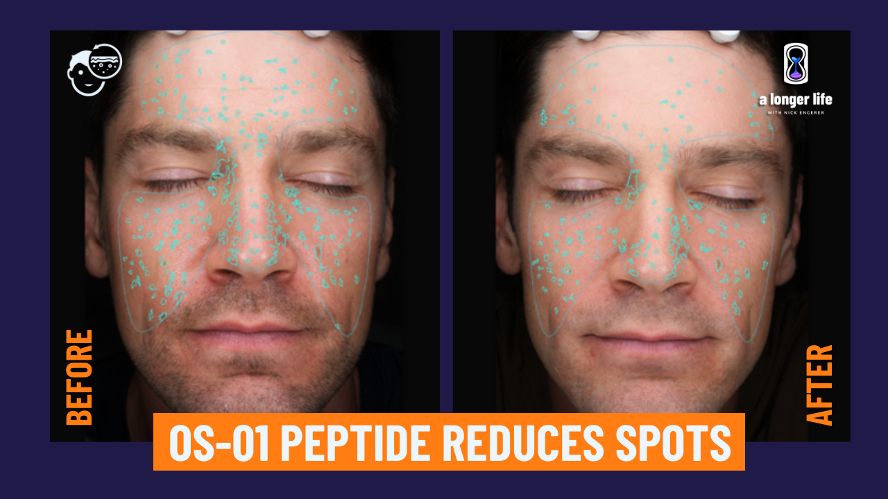 One year with OneSkin OS-01 - Review, questions and where to start — nickengerer.org