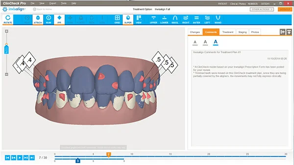 Invisalign® Clear Braces — What You Can Expect