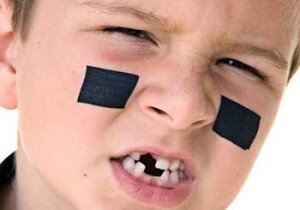 Treatment and advice for missing teeth