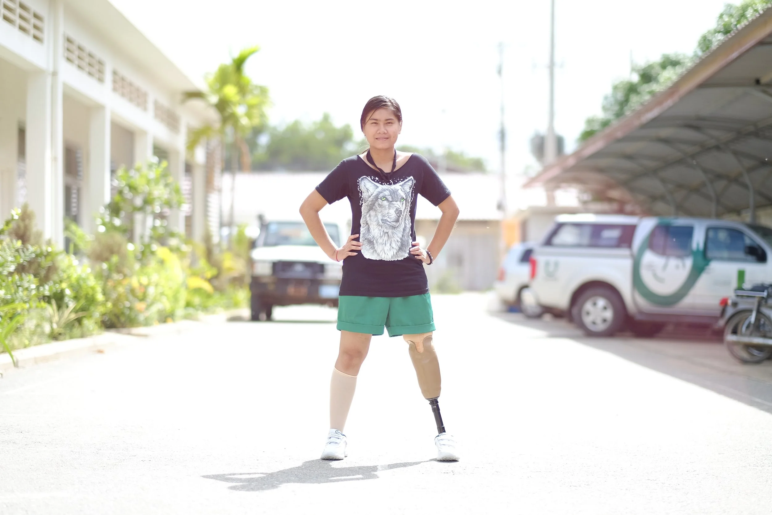 Seyha — A Leg To Stand On