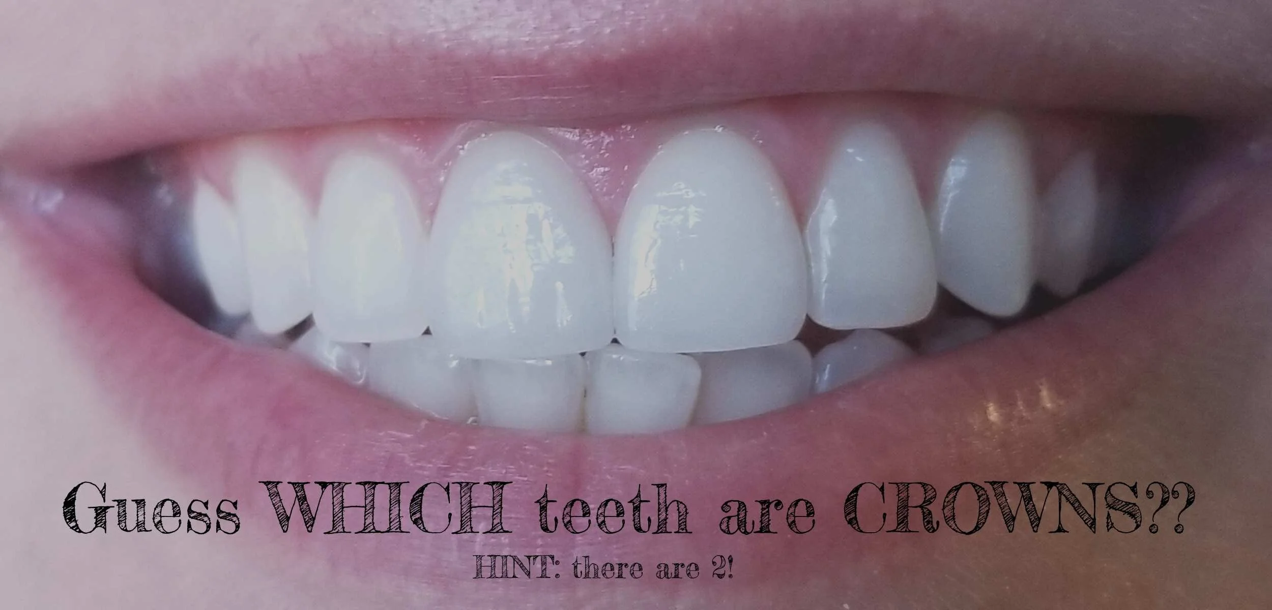 Life Changing. Beautiful. Cosmetic Dentistry - Ivory Dental Group