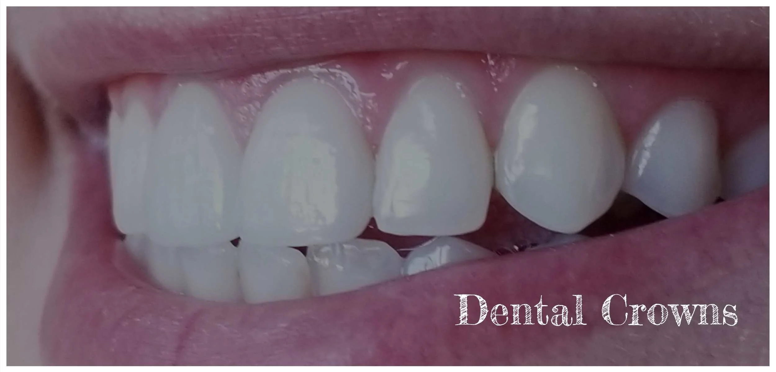 Life Changing. Beautiful. Cosmetic Dentistry - Ivory Dental Group