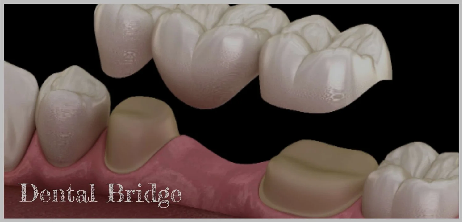 Life Changing. Beautiful. Cosmetic Dentistry - Ivory Dental Group