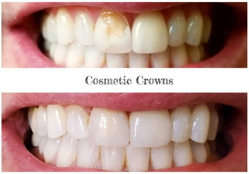 Life Changing. Beautiful. Cosmetic Dentistry - Ivory Dental Group