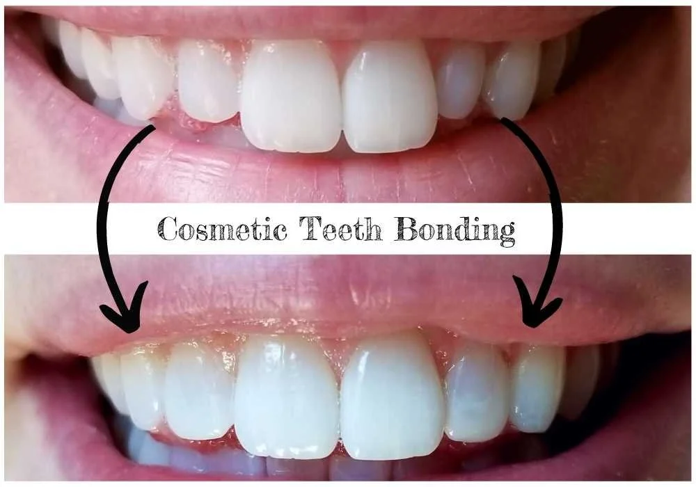 Life Changing. Beautiful. Cosmetic Dentistry - Ivory Dental Group