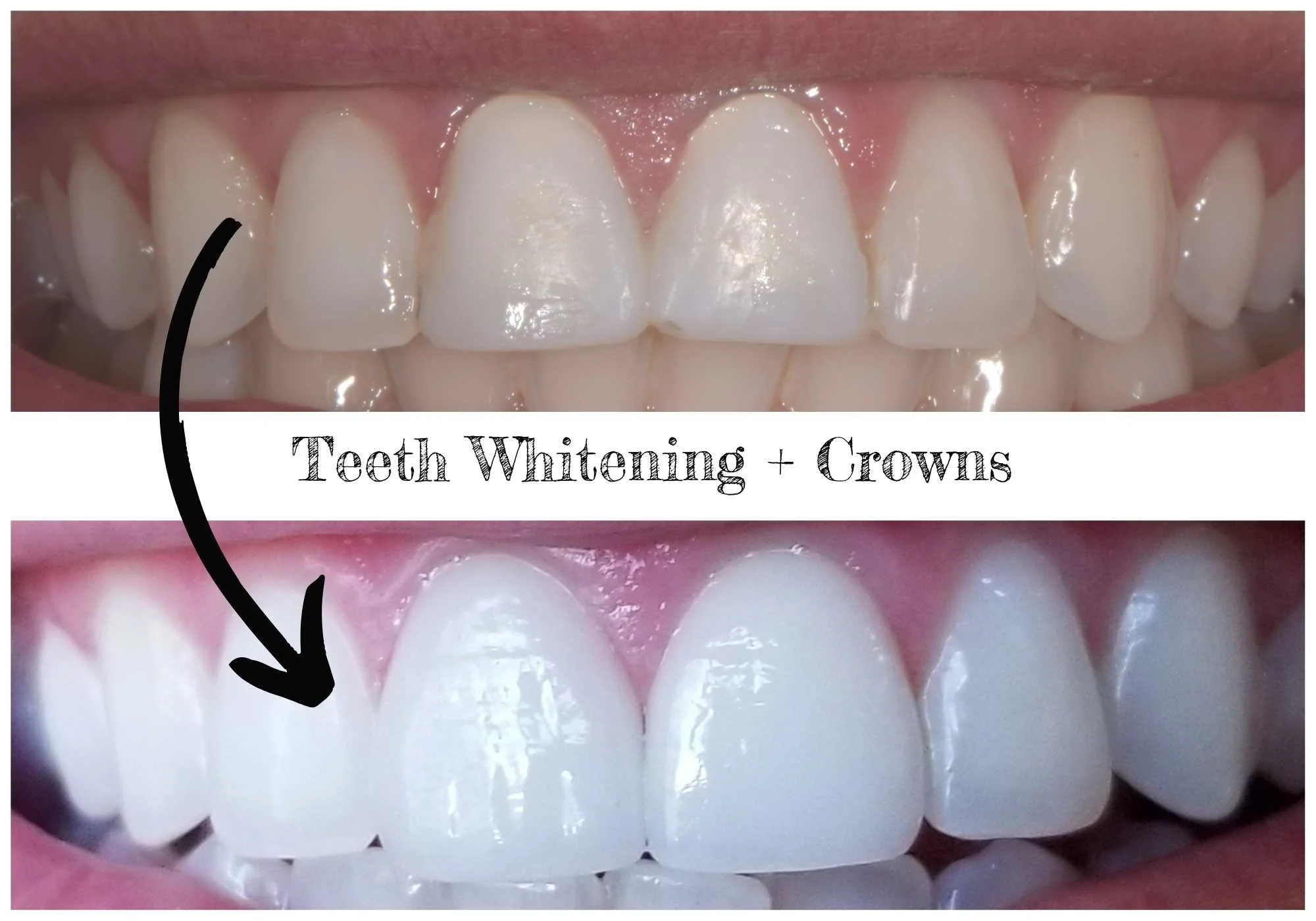 Life Changing. Beautiful. Cosmetic Dentistry - Ivory Dental Group