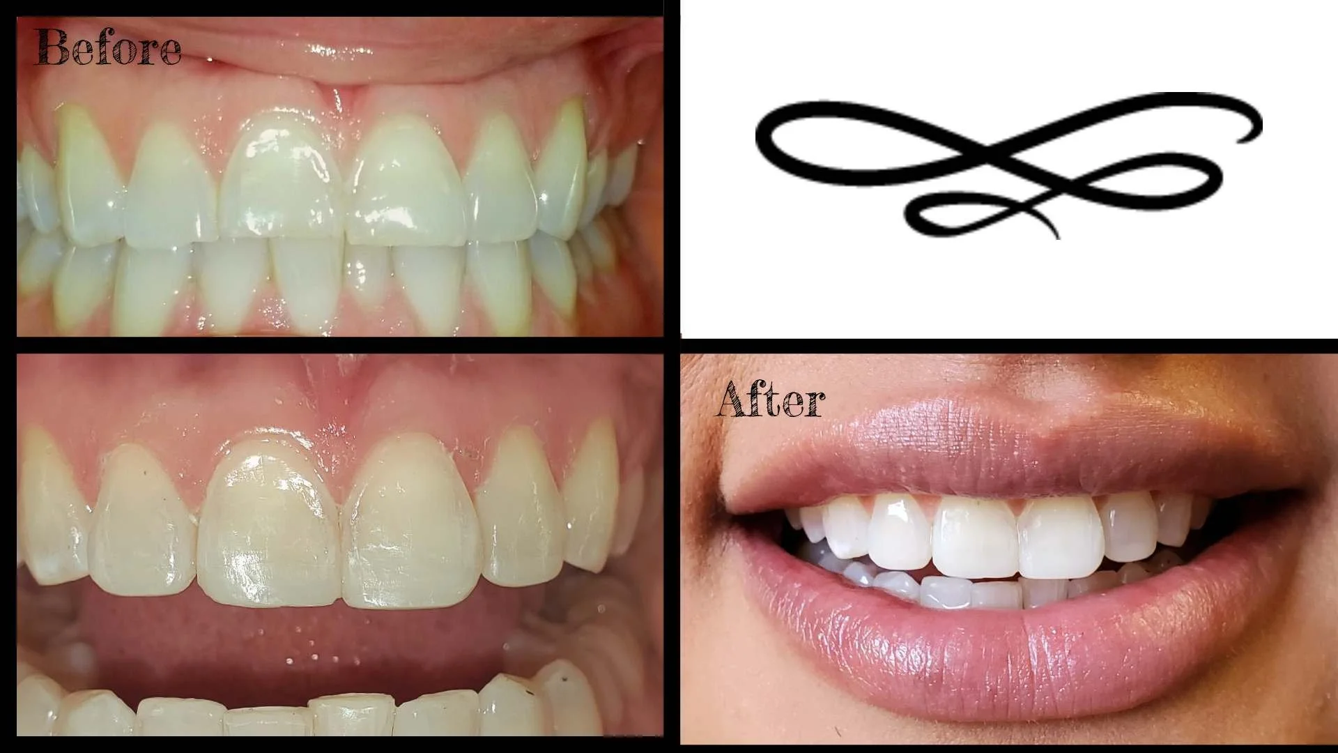 Life Changing. Beautiful. Cosmetic Dentistry - Ivory Dental Group