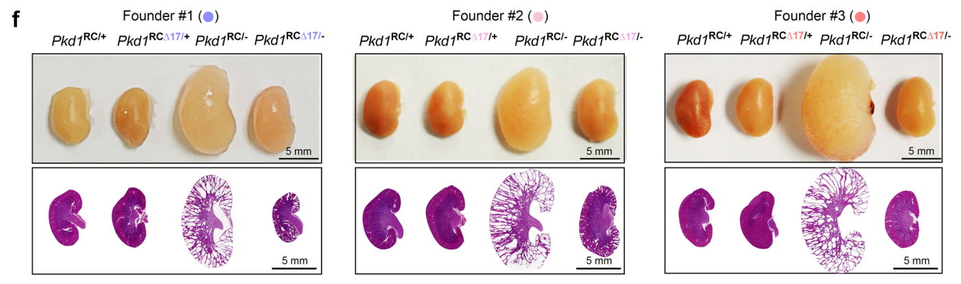 Role of mRNA cis-inhibition in PKD progression — NephJC