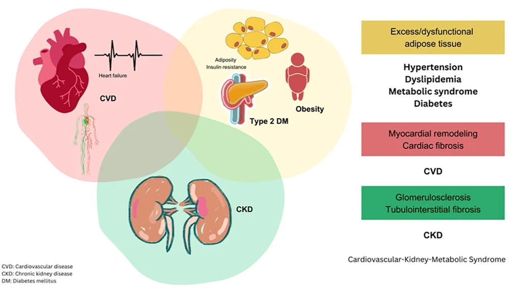 Re”FINE”ing the role of non steroidal MRAs in Cardio Kidney Metabolic ...