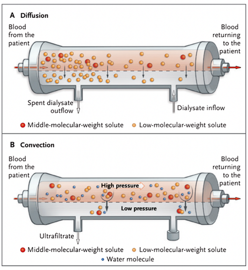 HDF vs HD: Need for CONVINCE-ing Evidence — NephJC