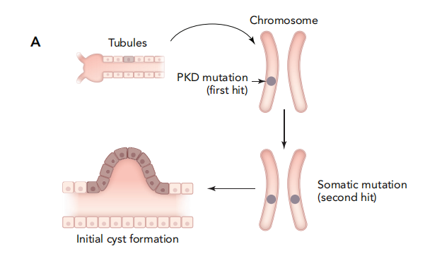 Role of mRNA cis-inhibition in PKD progression — NephJC