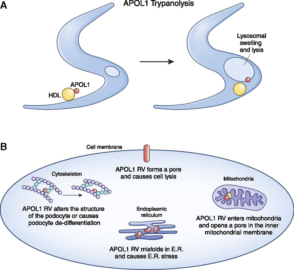 Inaxaplin and proteinuric kidney disease treatment:Taking the octopus ...