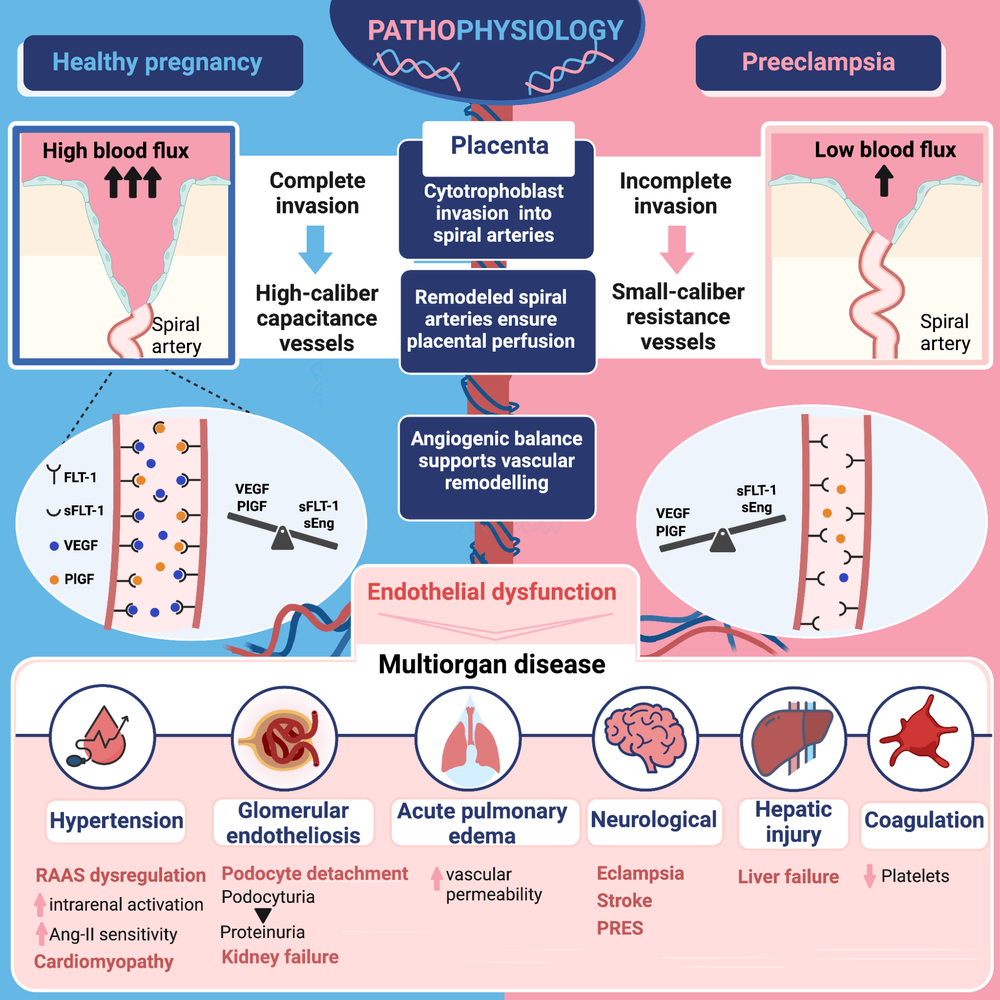 PRAECISely Predicting Preeclampsia — NephJC