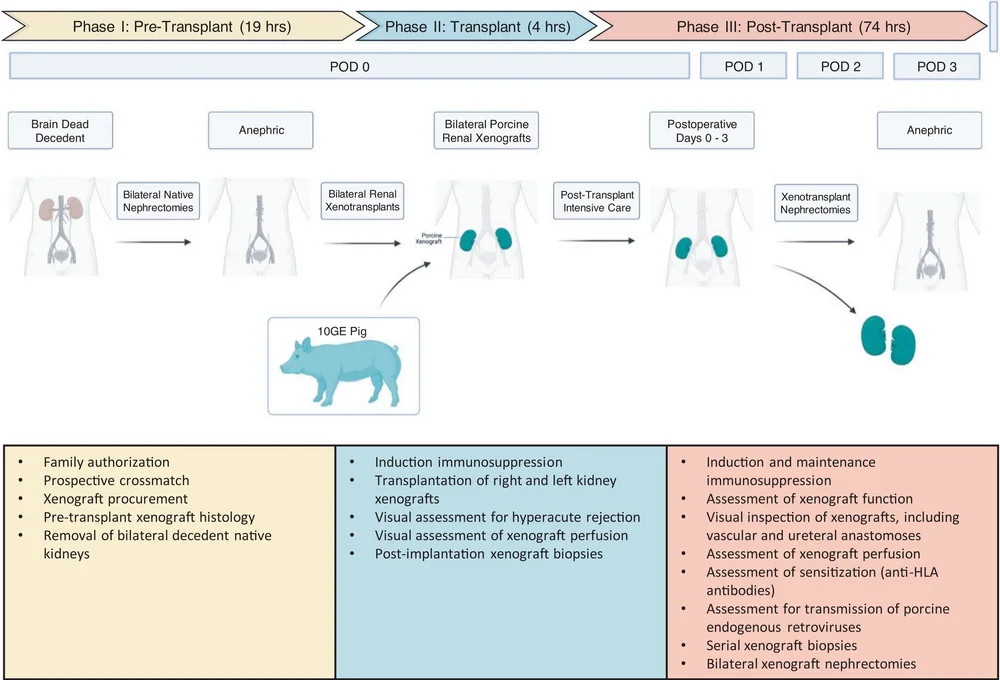 Xenotransplantation: The Future is Here-ish — NephJC