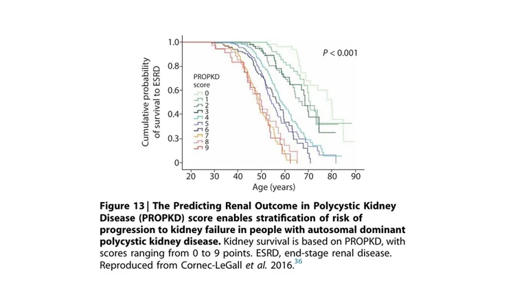 KDIGO 2025 ADPKD Guidelines Review — NephJC