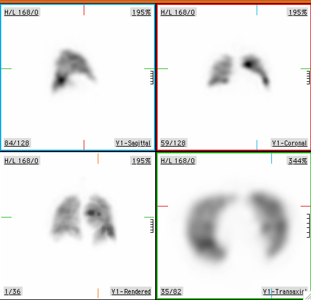 Nuclear Medicine and PET/CT images from the MedView by MedImage — MedImage
