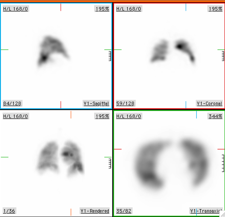 Nuclear Medicine and PET/CT images from the MedView by MedImage — MedImage