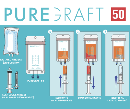 Adipose — PLYMOUTH MEDICAL