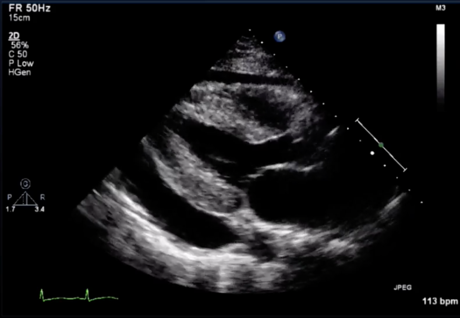 Ultrasound Leadership Academy: Basic Cardiac — EM Curious
