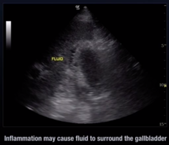 Ultrasound Leadership Academy Ruq Ultrasound — Em Curious