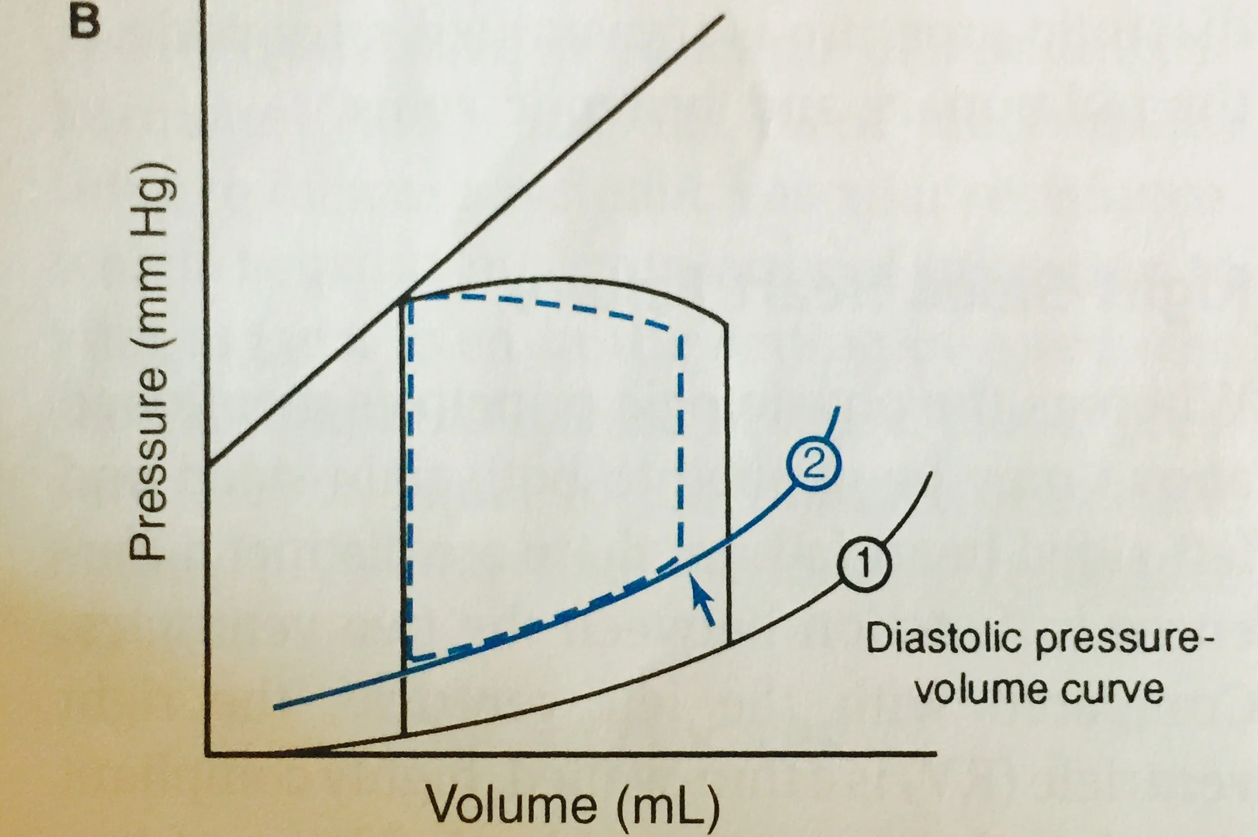 Ultrasound Leadership Academy: Diastology — EM Curious