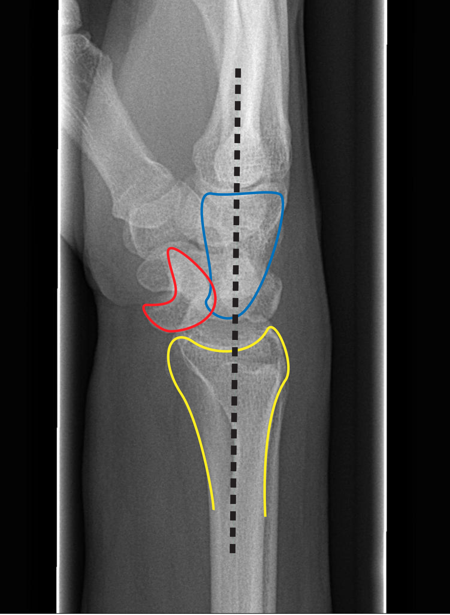 Not Your Typical Wrist Pain — EM Curious