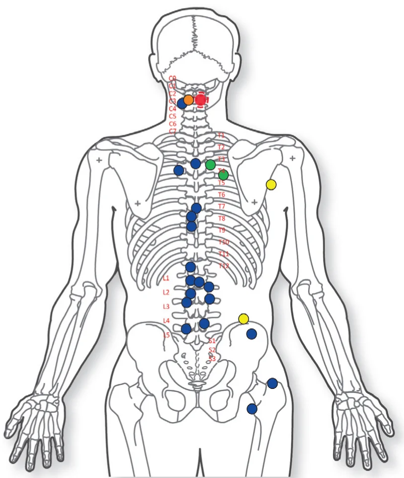 Physicians & Mid-Level — Spinal Reflex Institute, Intl.
