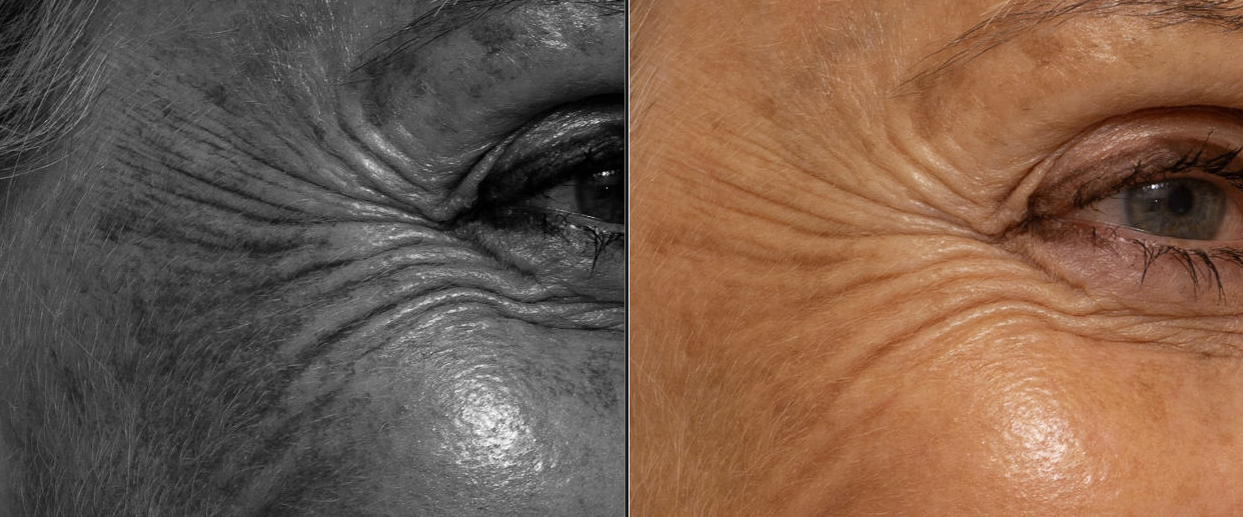 Skin Filters | Clinical Imaging Australia