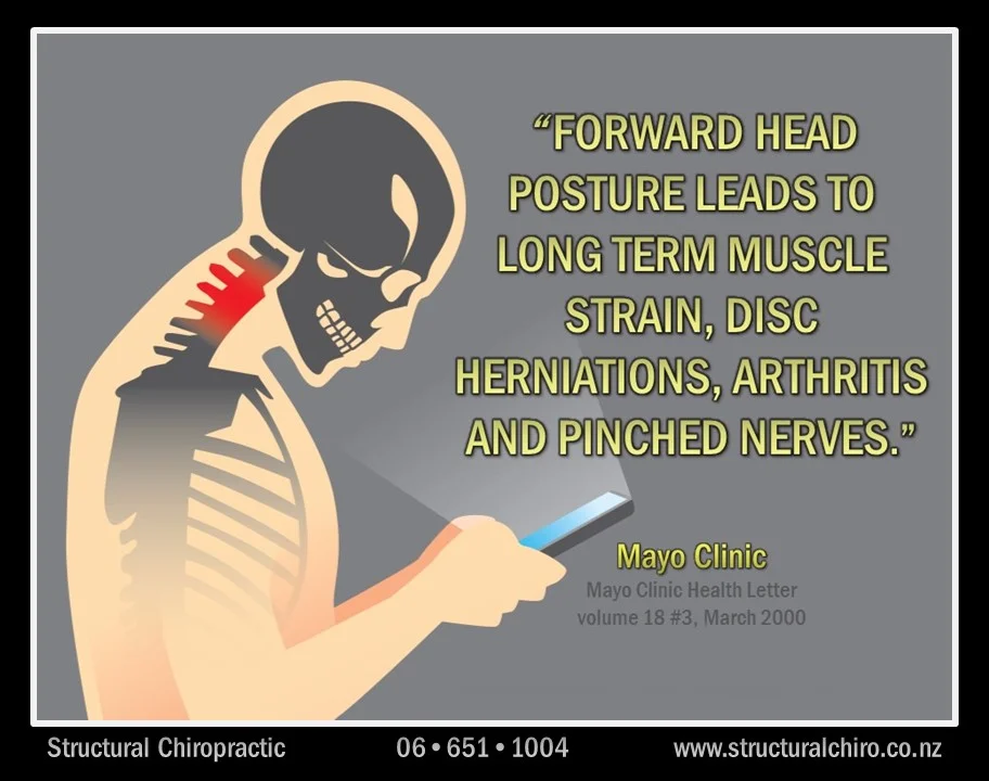 "Text Neck" is Real, who's at risk and what to do? — Structural ...