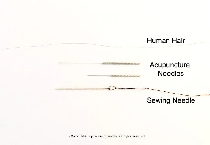 Acupuncture Needles Comparison