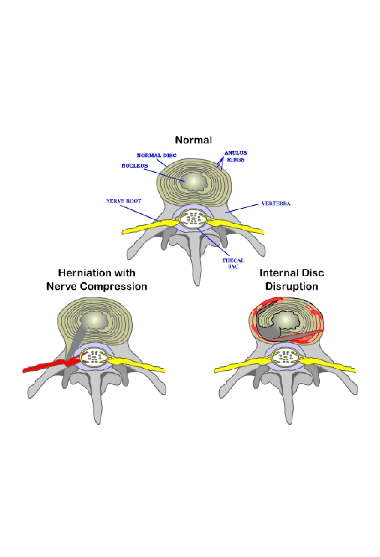 What is ELDOA Method? — ELDOA METHOD