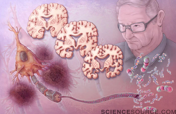 Diseases and Conditions | Medical Illustration - Science Source Images ...