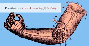 History of Prosthetics: From Ancient Egypt to Today — Science Source ...