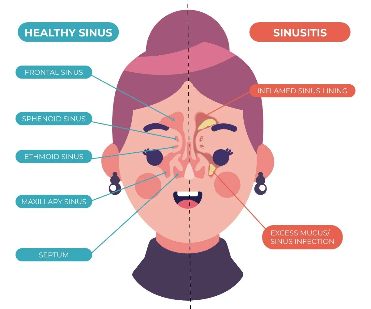 Should You Wash Out Your Nose? — Bridgit Danner, Holistic Detox Coach